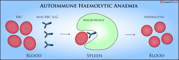 Autoimmune Haemolytic Anaemia - LearnHaem | Haematology Made Simple