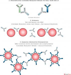 The Coombs Test - LearnHaem | Haematology Made Simple
