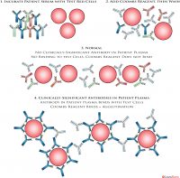 Indirect Coombs Test - LearnHaem | Haematology Made Simple