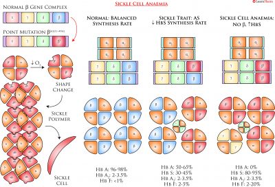 Sickle Cell Anaemia - LearnHaem | Haematology Made Simple