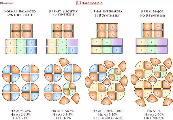 ß Thalassaemia - LearnHaem | Haematology Made Simple