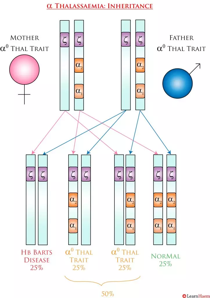 α Thalassaemia - LearnHaem | Haematology Made Simple