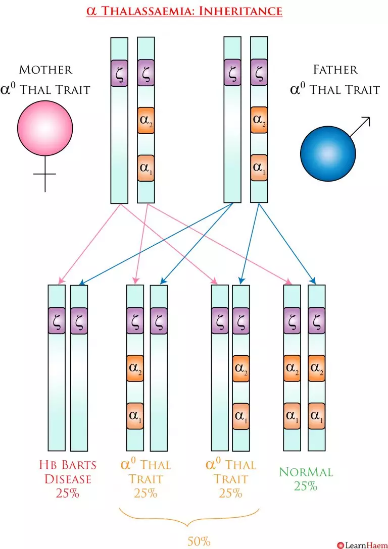 α Thalassaemia - LearnHaem | Haematology Made Simple