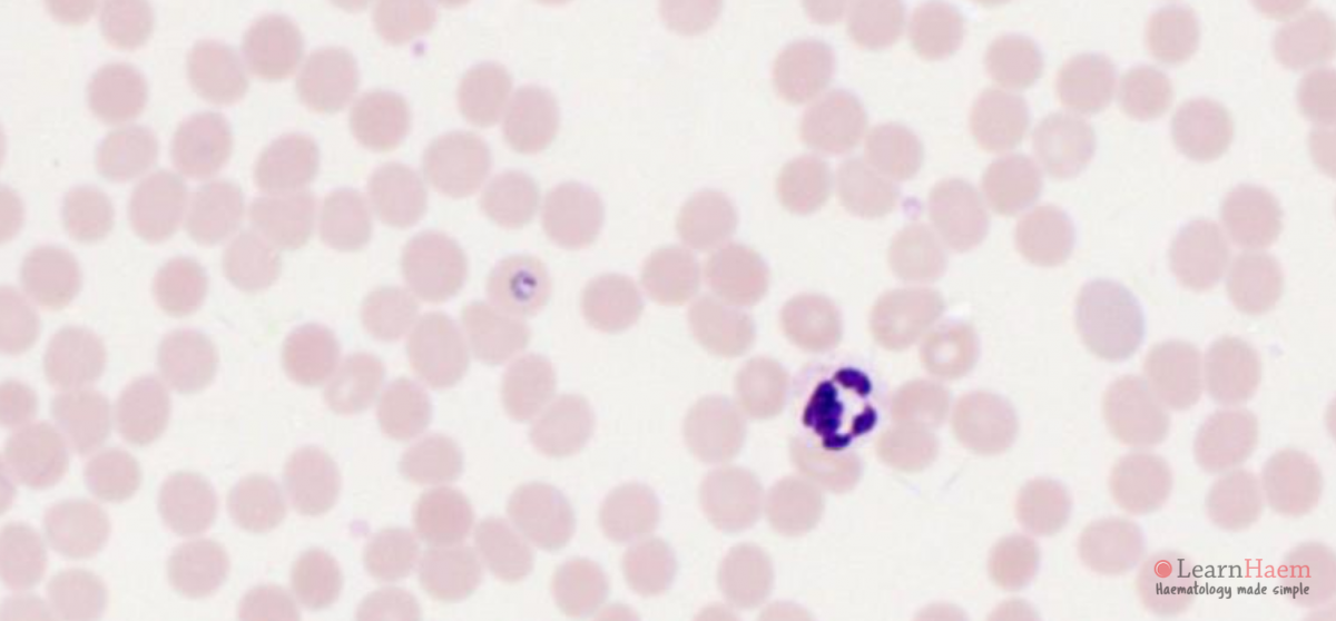 P. vivax and P. ovale - LearnHaem | Haematology Made Simple