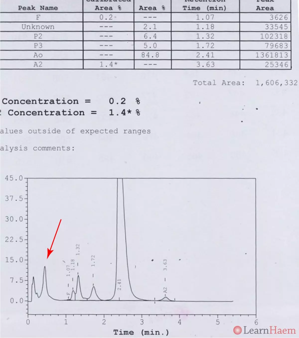Haemoglobin H (HbH) Disease - LearnHaem | Haematology Made Simple