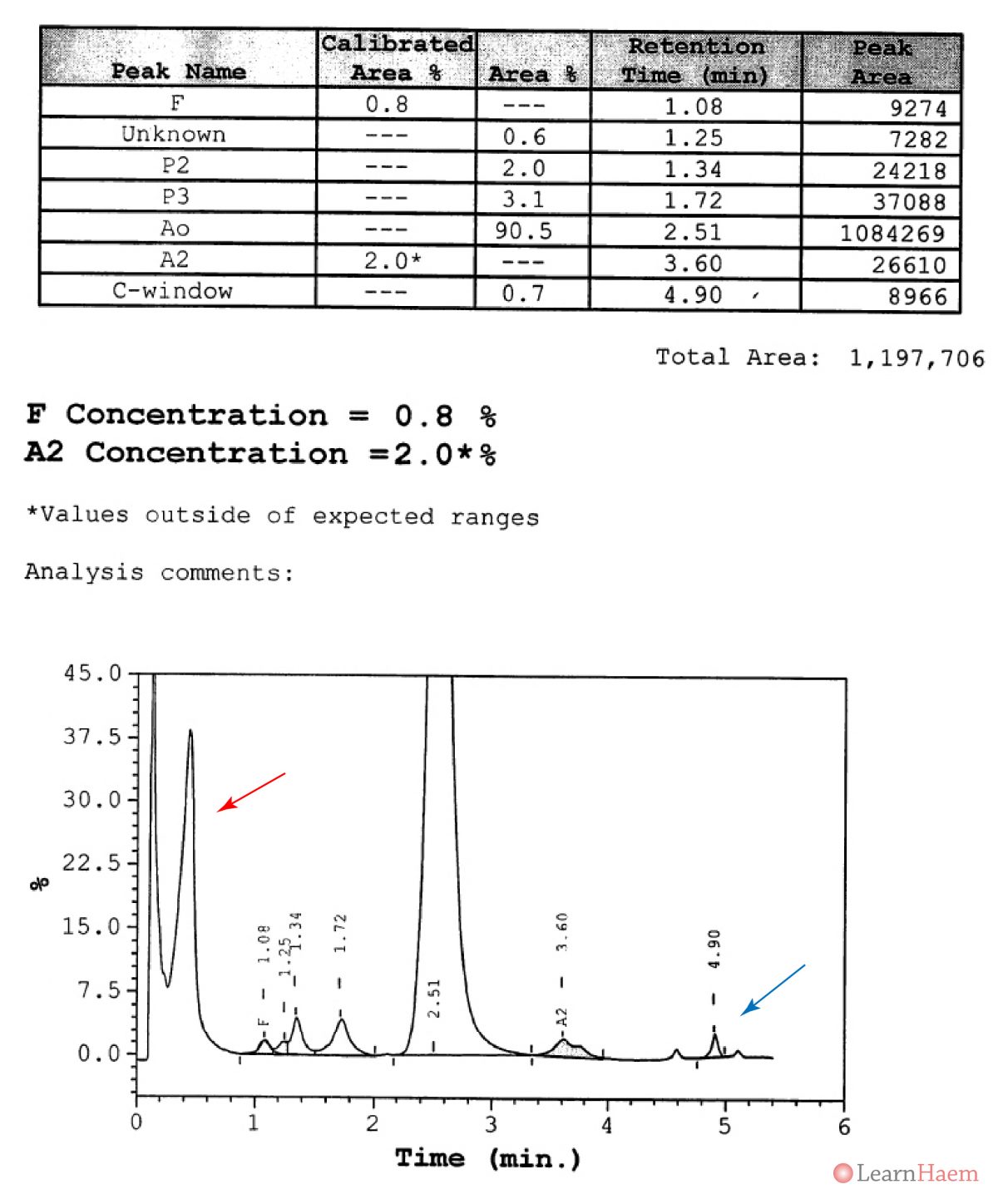Haemoglobin H-Constant Spring Disease - LearnHaem | Haematology Made Simple
