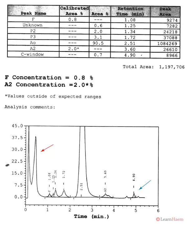 Haemoglobin H-Constant Spring Disease - LearnHaem | Haematology Made Simple