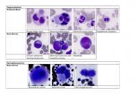 MDS Overview - LearnHaem | Haematology Made Simple