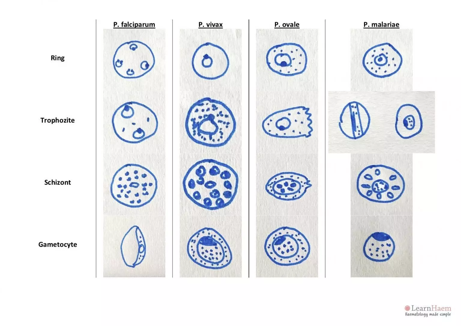 Malaria - Overview - LearnHaem | Haematology Made Simple