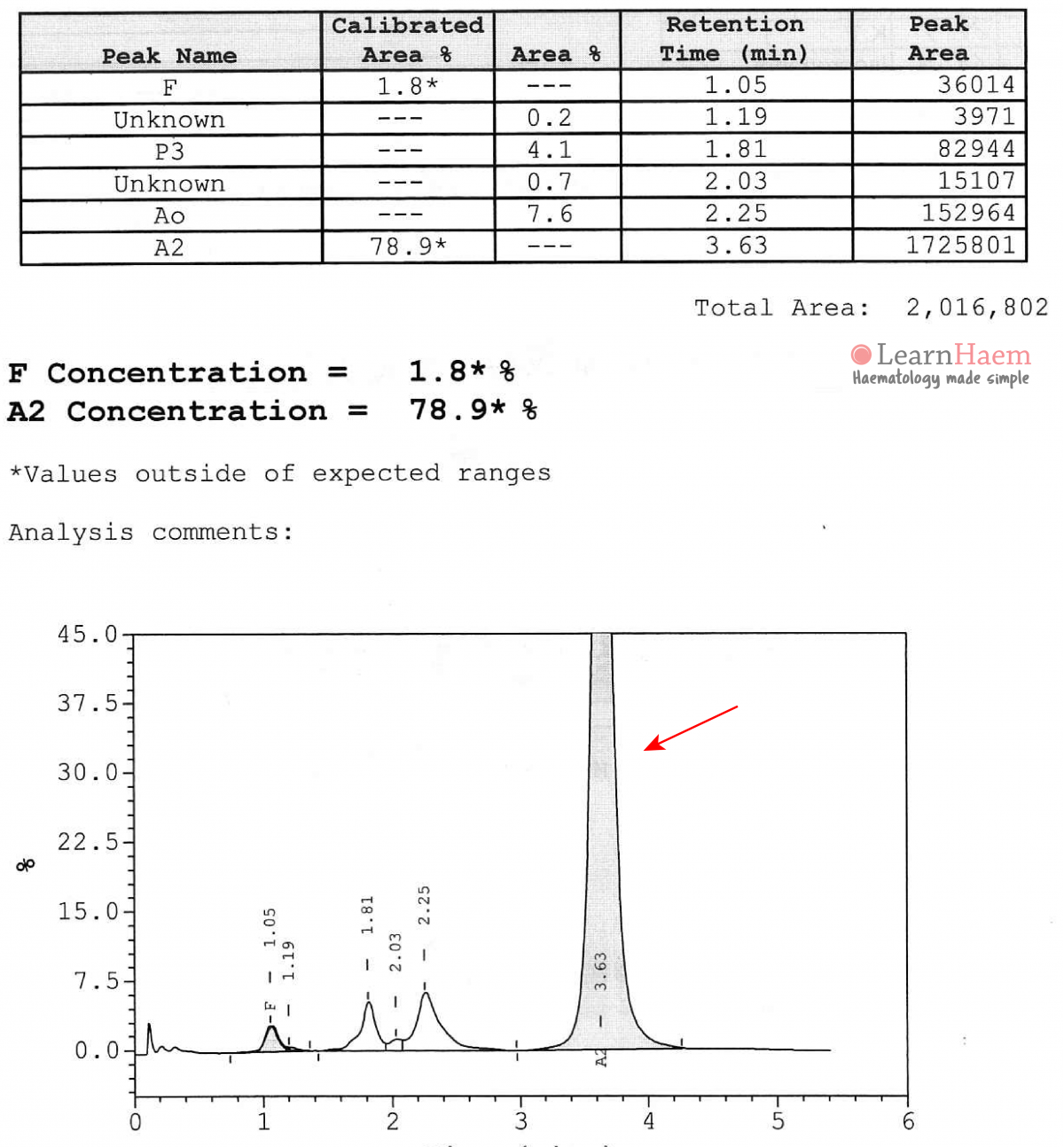 Haemoglobin E - LearnHaem | Haematology Made Simple
