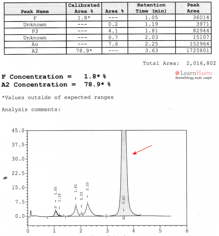 Haemoglobin E - LearnHaem | Haematology Made Simple