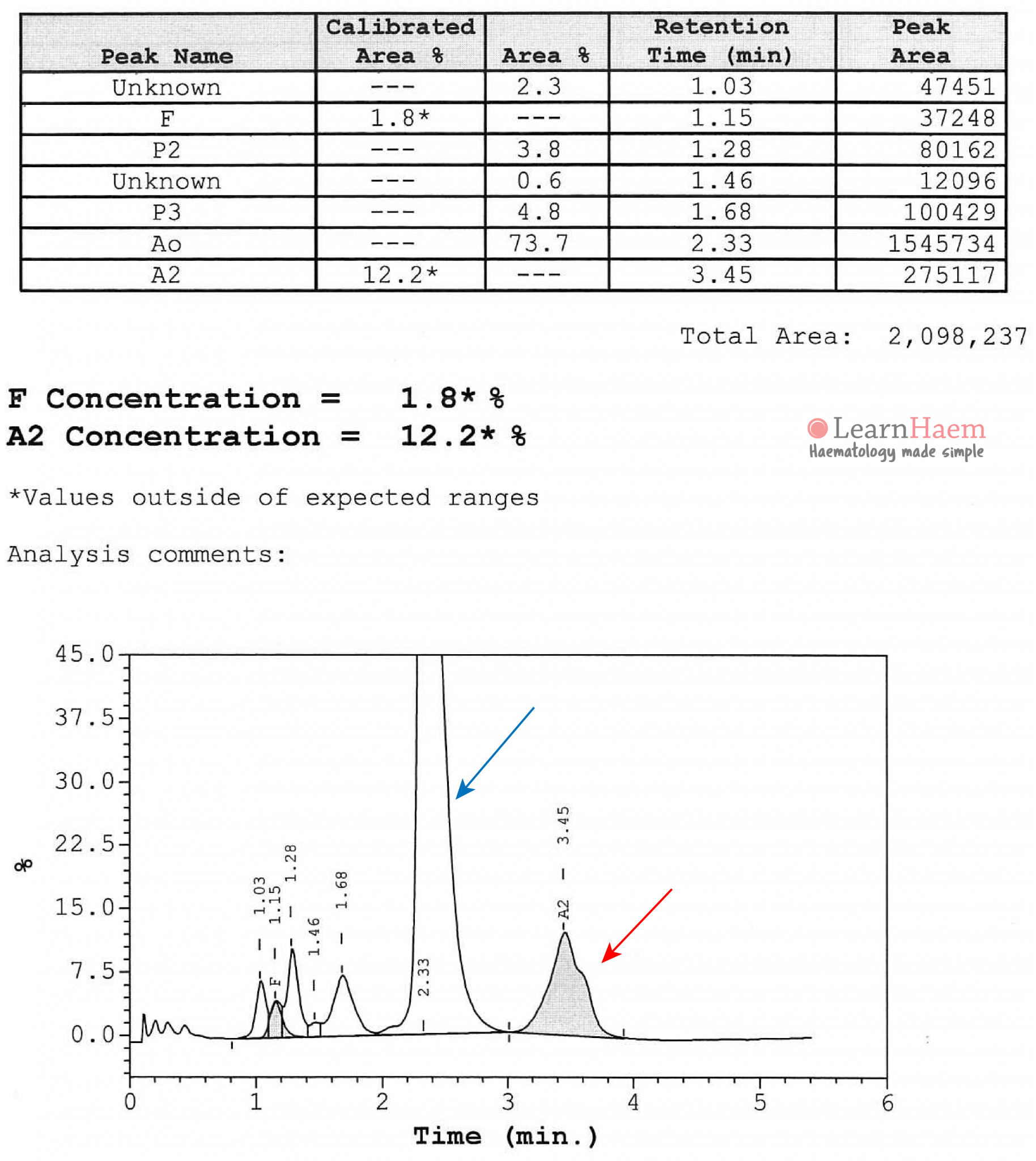 Haemoglobin Lepore - LearnHaem | Haematology Made Simple