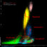 Blast Window - LearnHaem | Haematology Made Simple