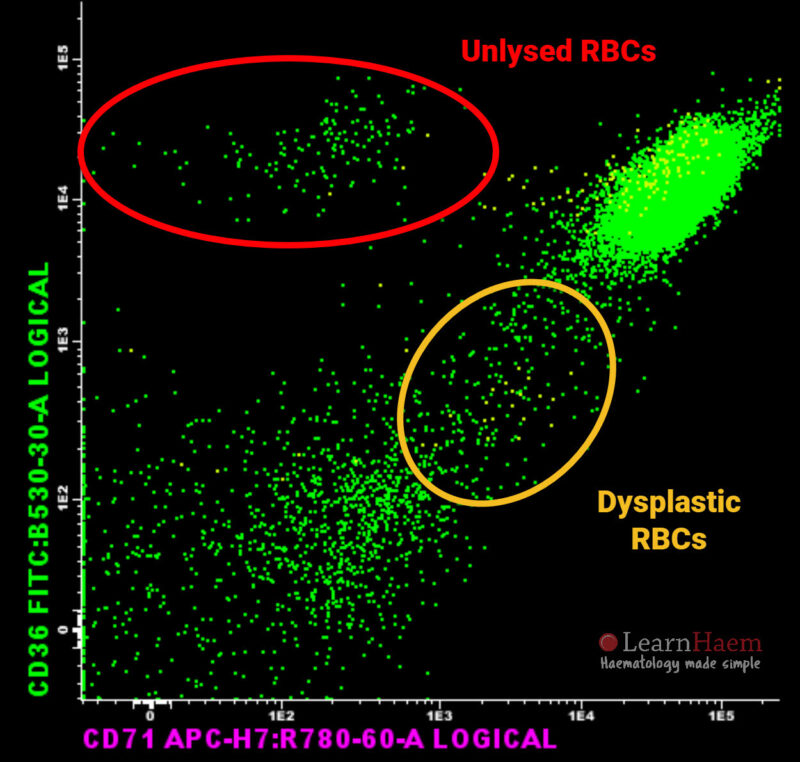 Normal Erythroid Maturation - LearnHaem | Haematology Made Simple