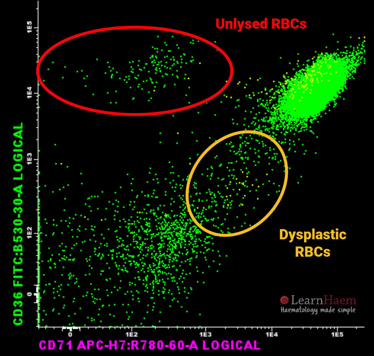Normal Erythroid Maturation - LearnHaem | Haematology Made Simple