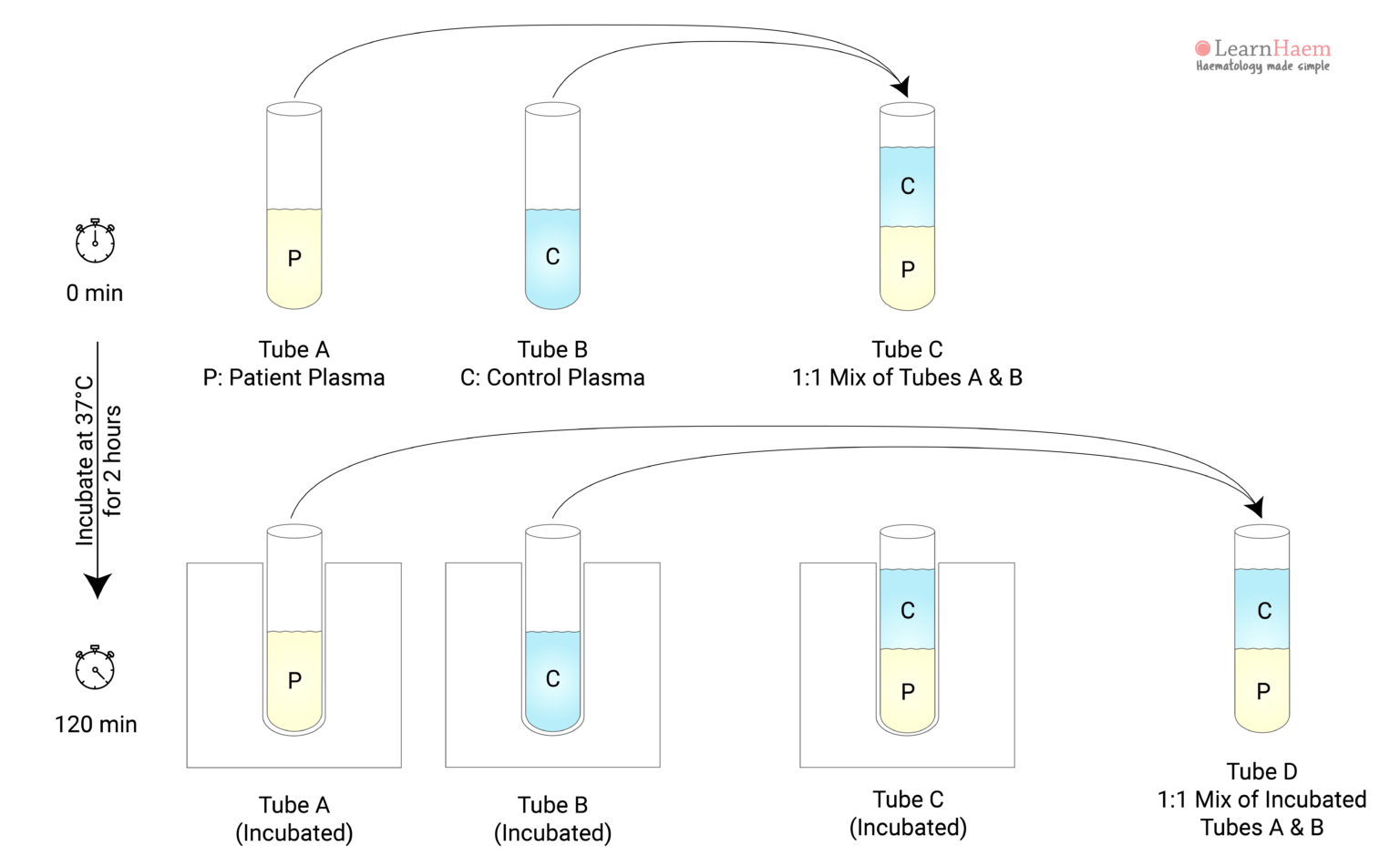 Inhibitor Screen - LearnHaem | Haematology Made Simple