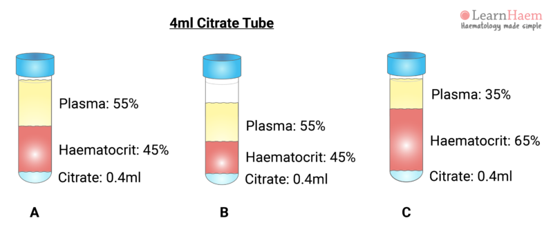 Sample Collection - LearnHaem | Haematology Made Simple