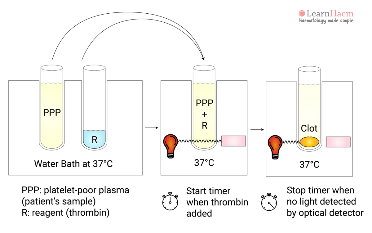 Thrombin Time (TT) - LearnHaem | Haematology Made Simple