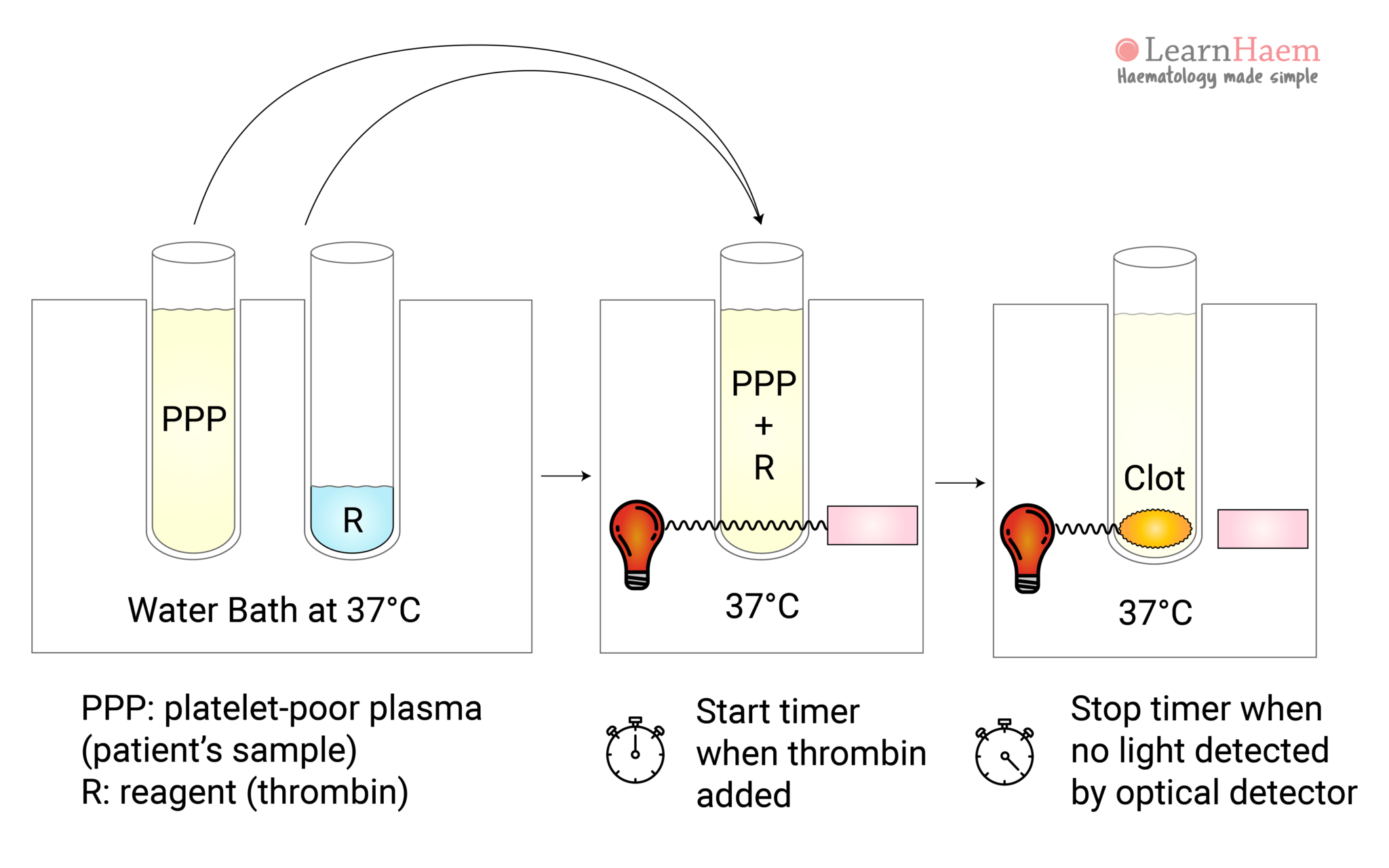 Thrombin Time TT LearnHaem Haematology Made Simple